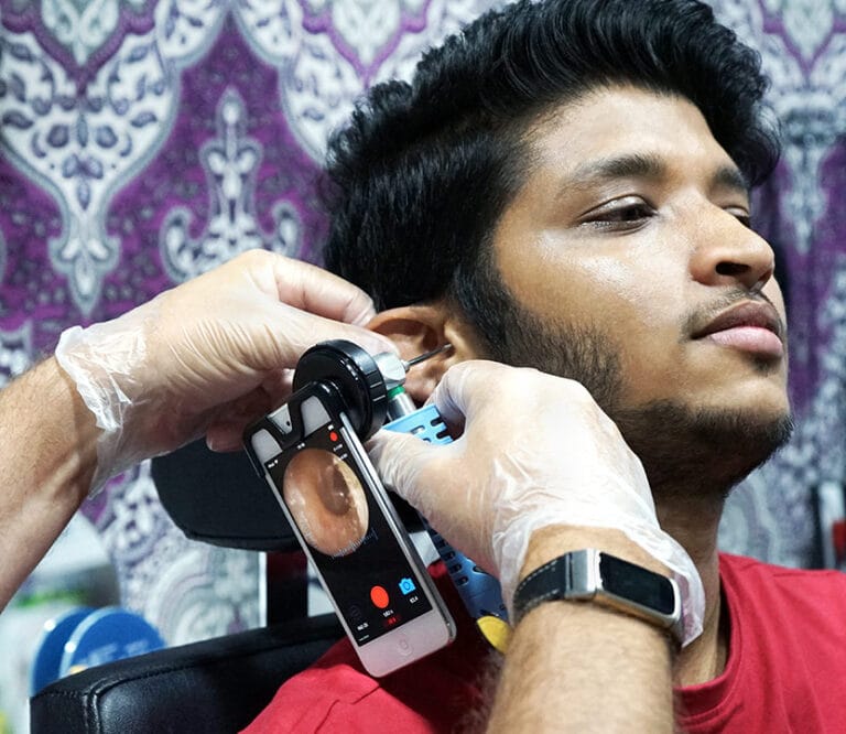 Endoscopic Microsuction - Ear Wax Removal Method - Hear4u